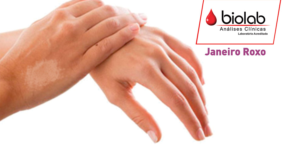 Hanseníase: Saiba mais sobre esta doença - Janeiro Roxo - Dicas de ...